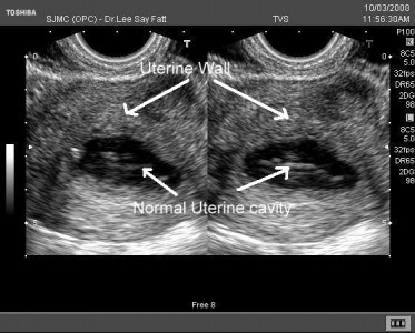 SIS images – Women's Health by Dr Lee Say Fatt