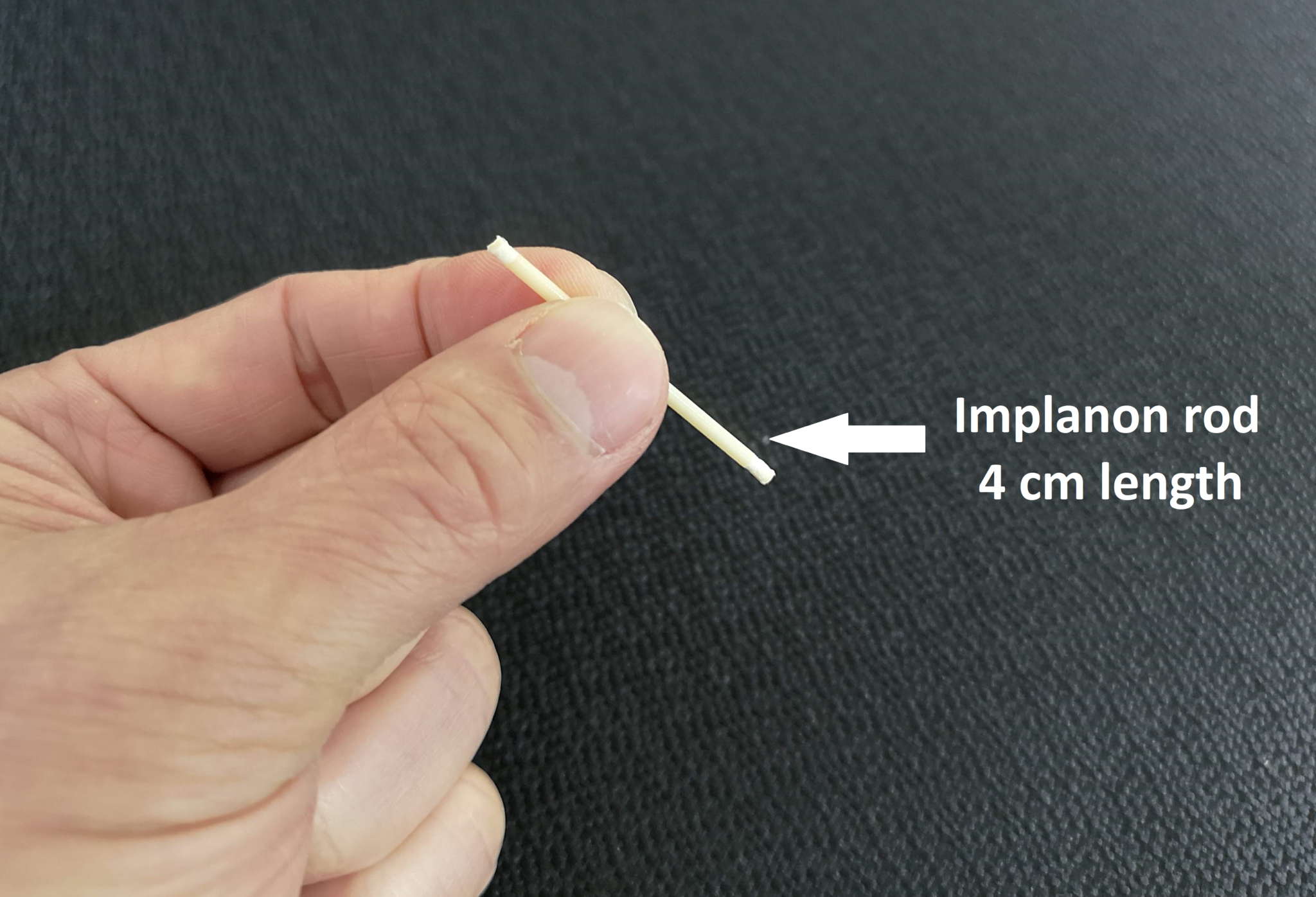 Contraception – Hormonal implant (Implanon) – Women's Health by Dr Lee ...